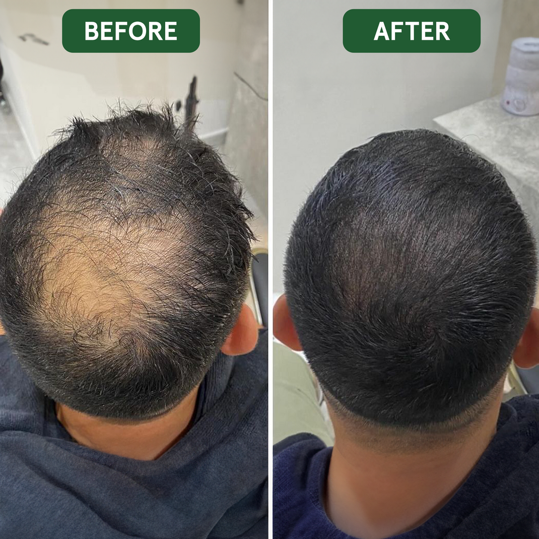 100% Organic Batana Hair Growth Oil – Divine Vitals